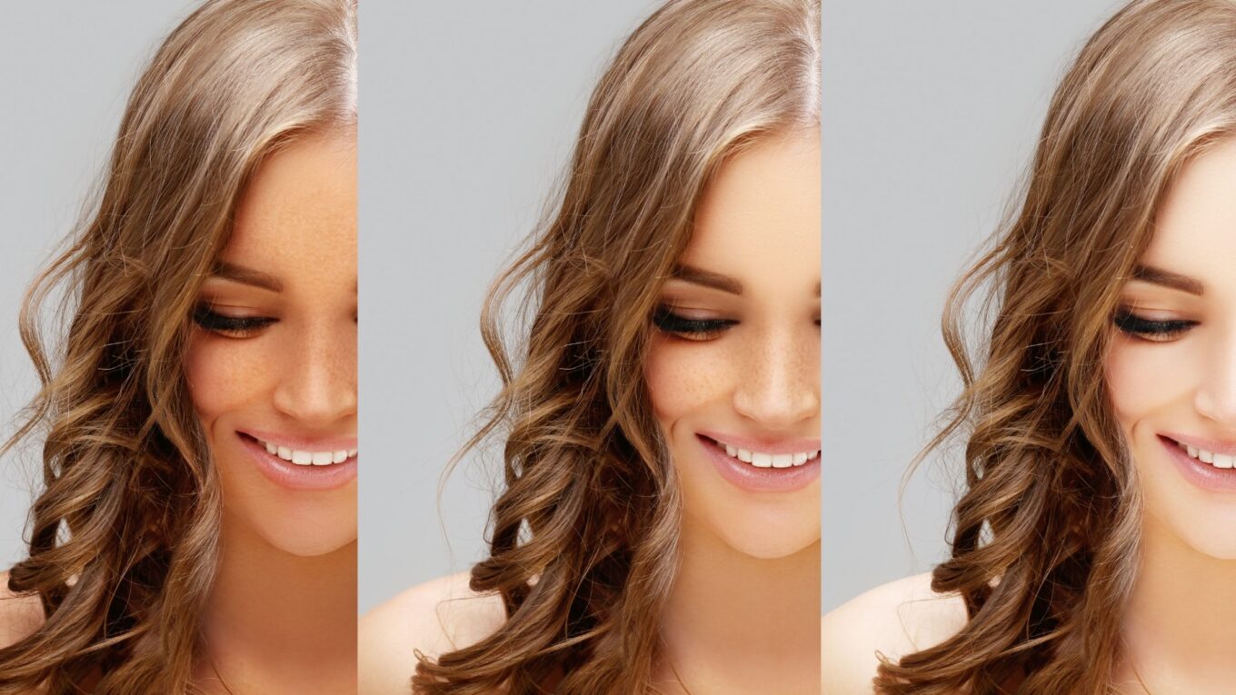 Skin Lightening Treatment in India: Types, Preparation & Aftercare