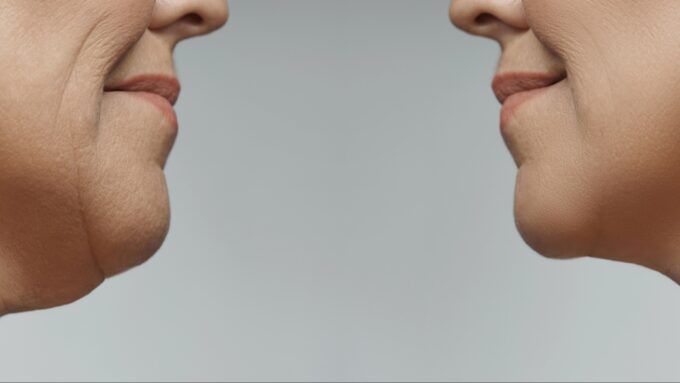 9 Ways to get a perfect jawline | Dr. Renu