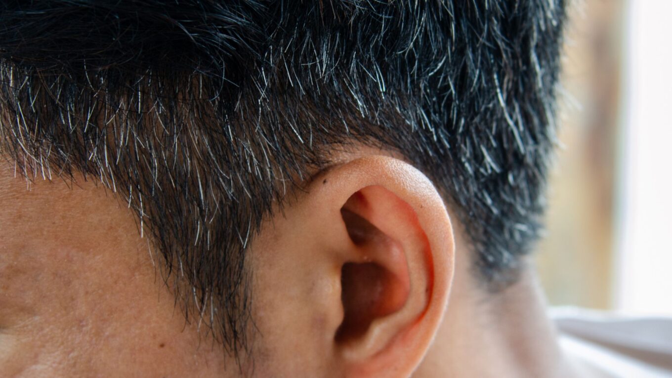 Premature Greying Of Hair: Causes & Tips To Avoid - Dr.Renu | Dermatologist