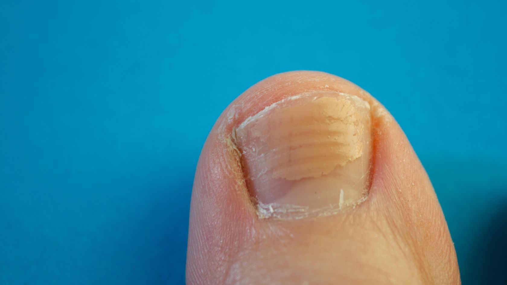 How To Take Care Of Your Feet: Skincare Guide - Dr.Renu | Dermatologist