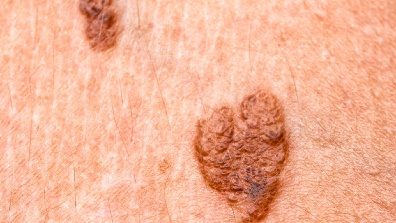 10 Ways To Recognize An Emergency From Your Skin - Dr.Renu | Dermatologist