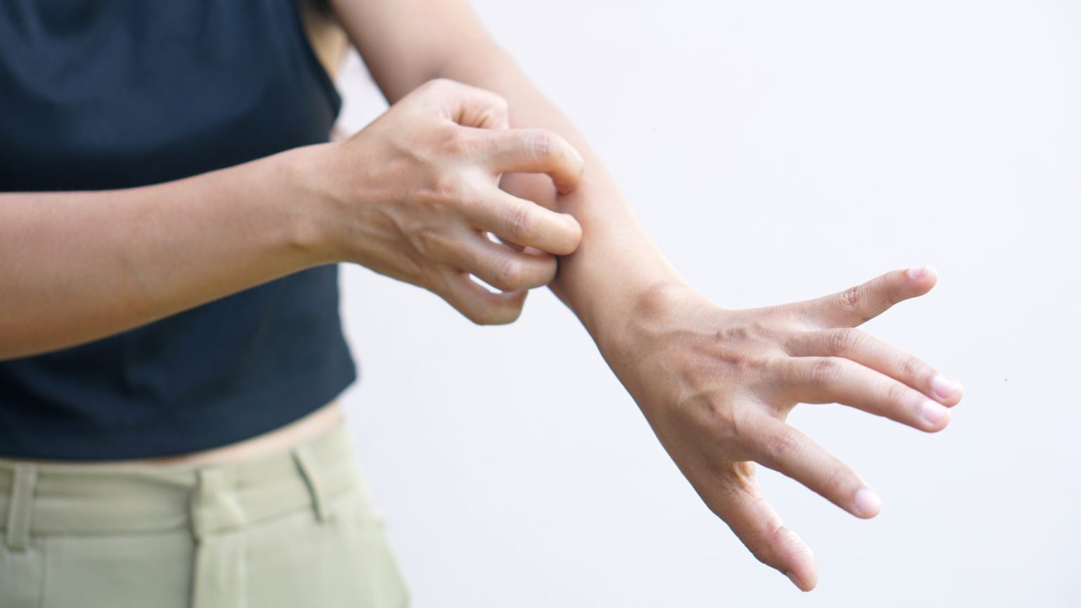 Treatment For Itchy Skin Without Rashes: Best Dermatologist in HSR ...